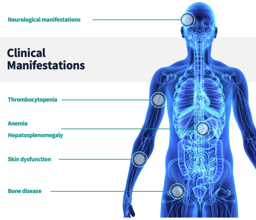 Science & Pipeline - Vanqua Bio